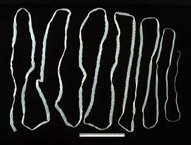 Finnosis (cysticercosis) amin'ny omby: inona izany, aretina, fitsaboana, fisorohana 3857_1