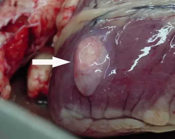 Finnoze (cysticercosis) liellopiem: kas tas ir, diagnostika, ārstēšana, profilakse 3857_5