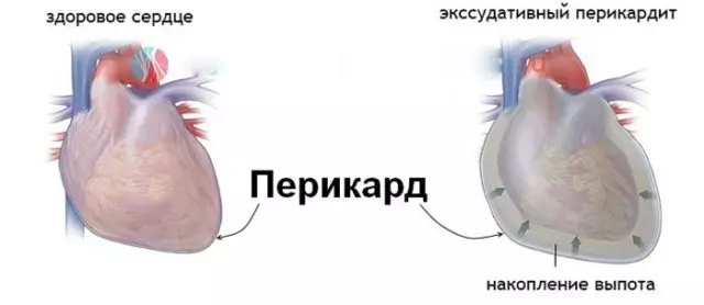 Сиырлардағы травматикалық перикардит: белгілері, емі, болжамы және алдын алу 8845_1