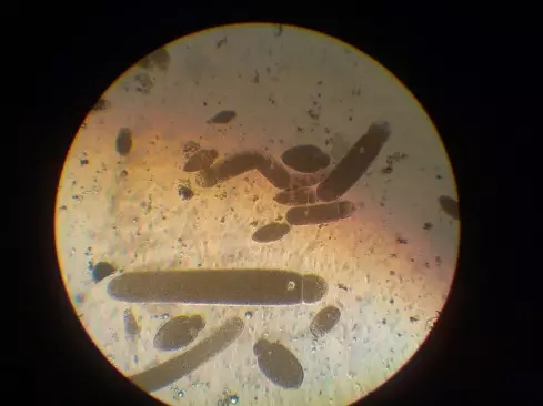 Bienenkrankheiten: Akarose, Braulose, Viruslähmung, Durchfall, Hafniasis, Behandlung 9012_18